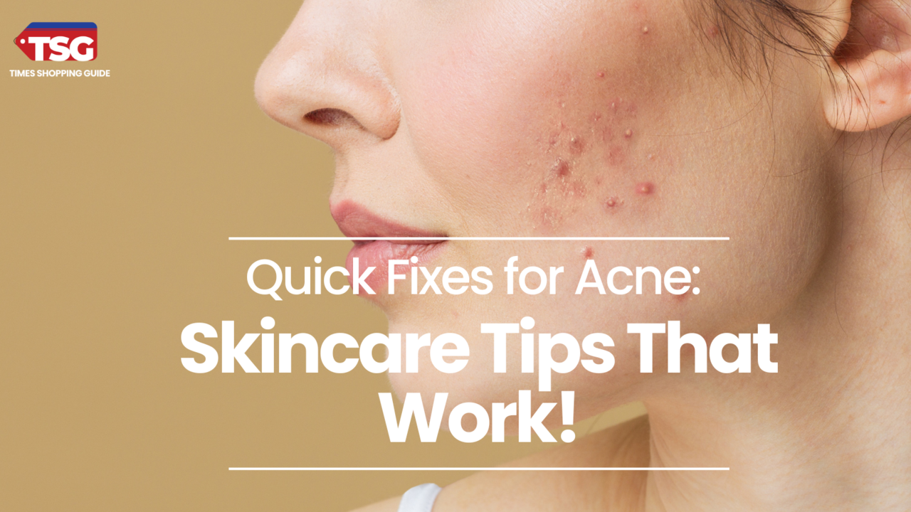 Best Skincare Tips to Remove Acne Fast